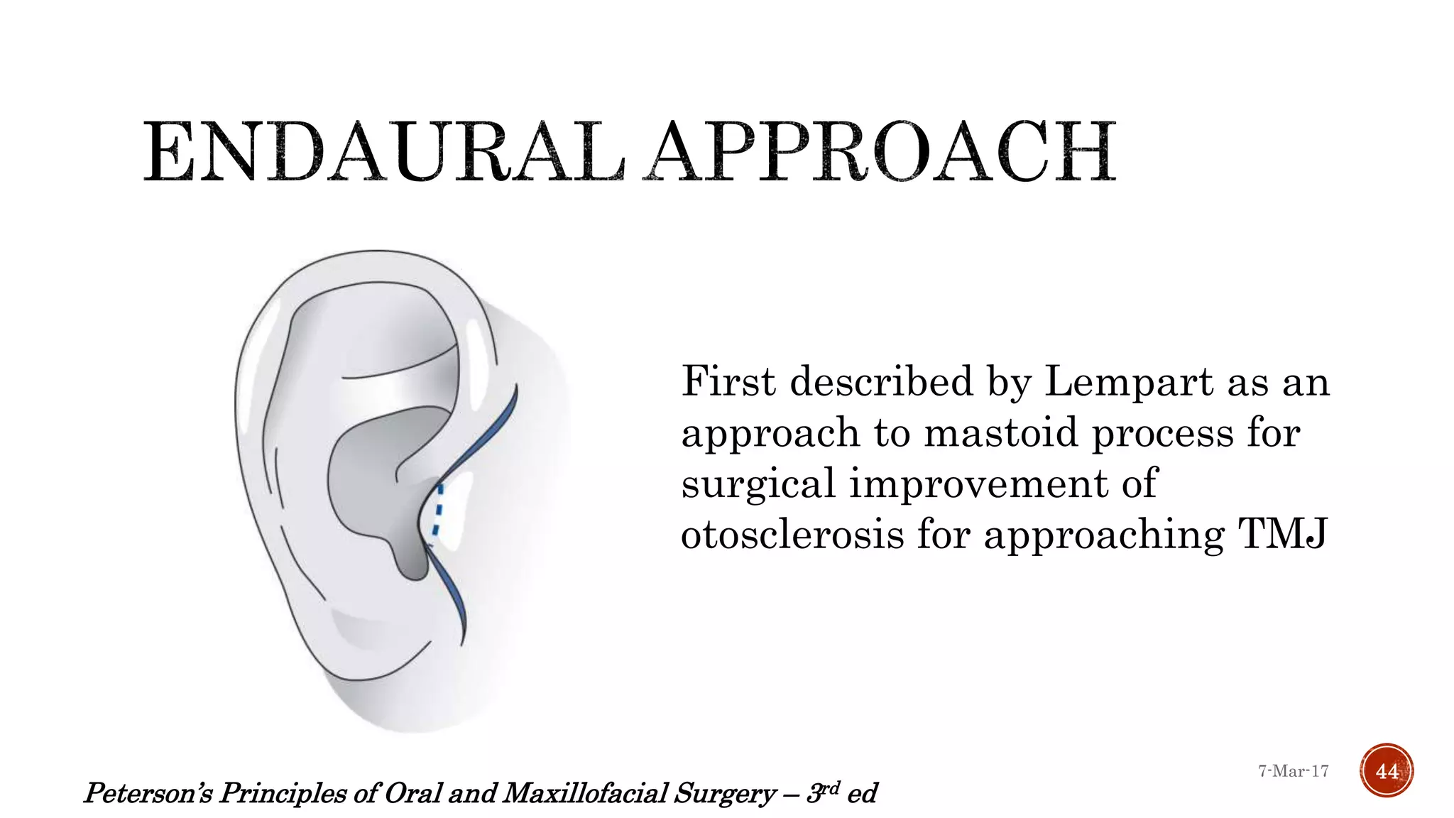 Surgical approaches to tmj | PPTX | Ear, Nose and Throat Conditions ...