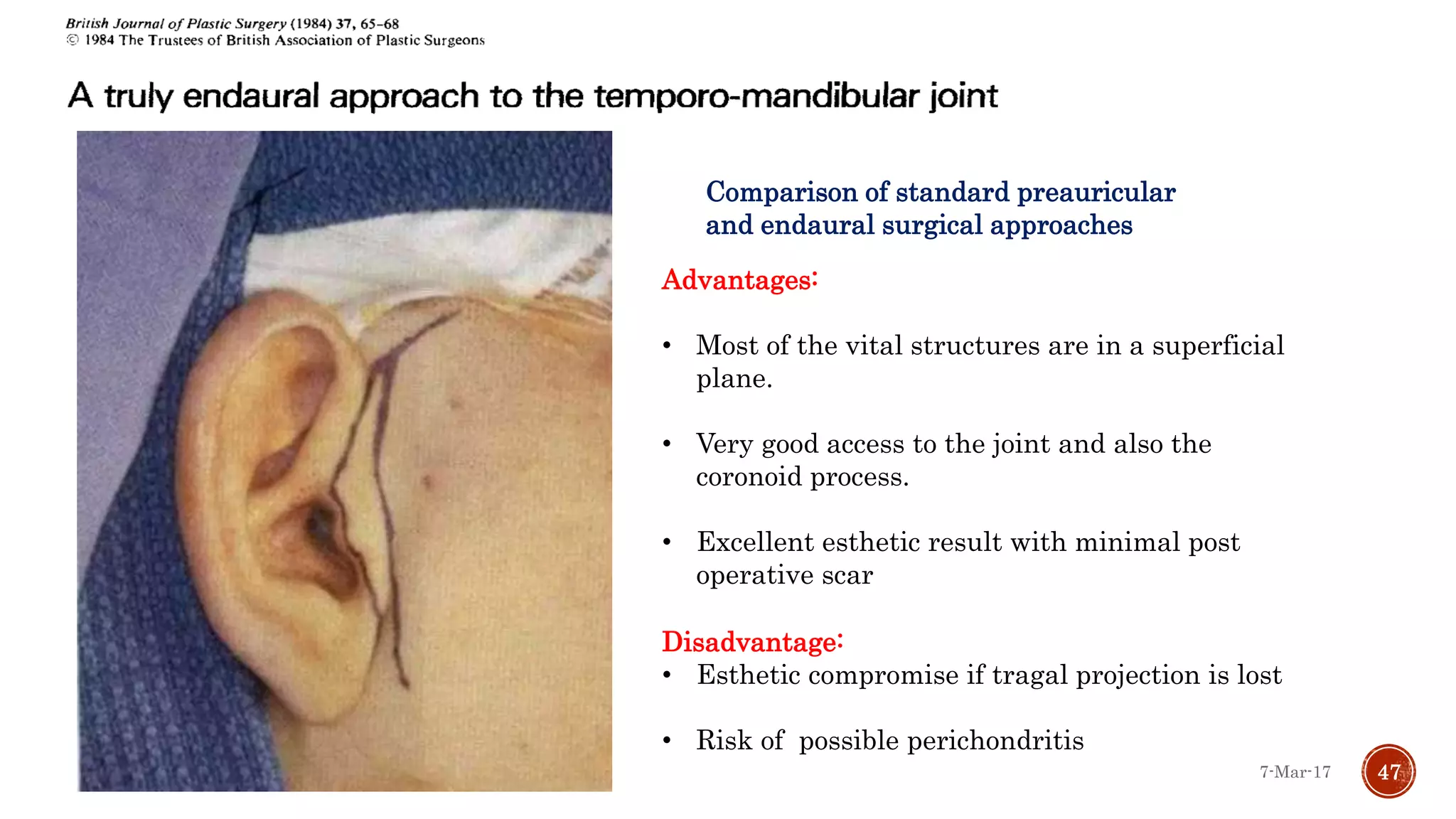 Surgical approaches to tmj | PPTX | Ear, Nose and Throat Conditions ...