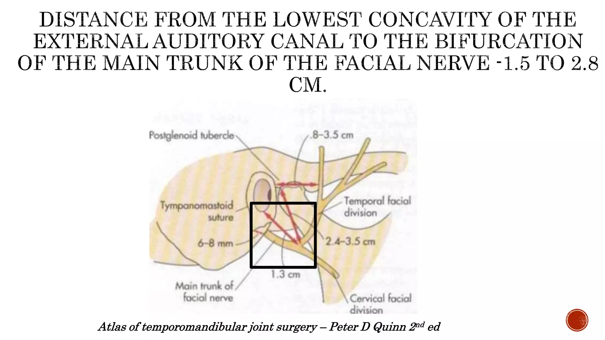 Surgical approaches to tmj | PPTX