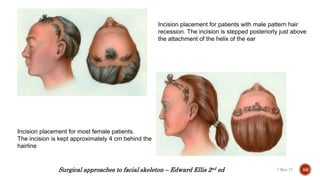 Surgical approaches to tmj | PPTX