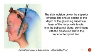 Surgical approaches to tmj | PPTX
