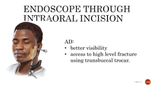 Surgical approaches to tmj | PPTX