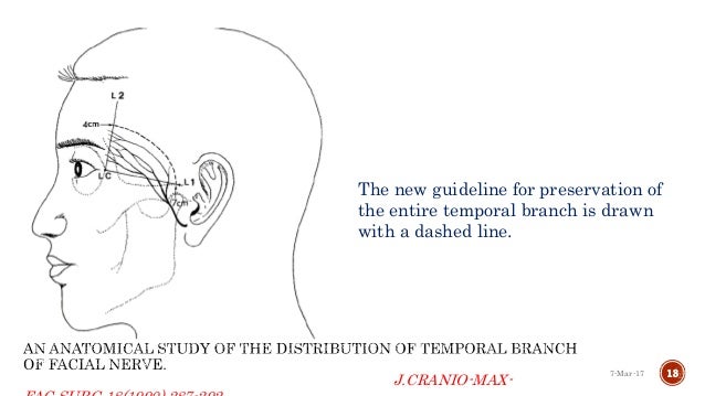 Surgical approaches to tmj