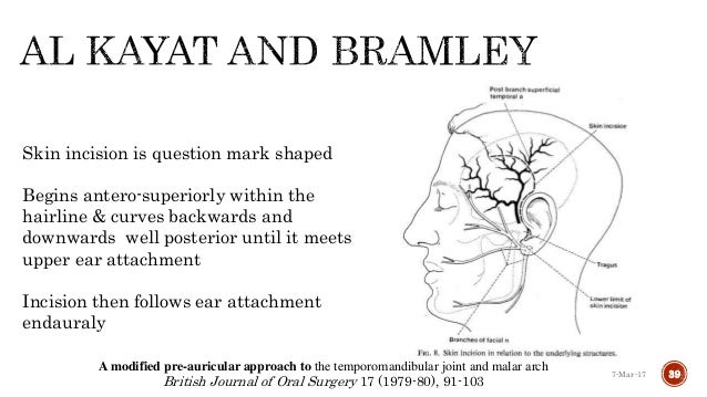 Surgical approaches to tmj