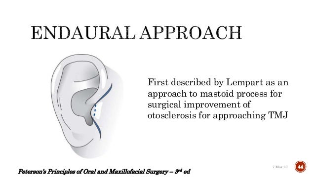 Surgical approaches to tmj