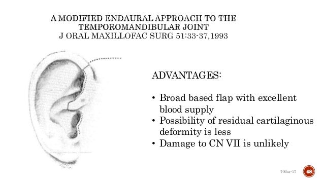 Surgical approaches to tmj