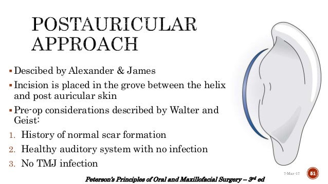 Surgical approaches to tmj