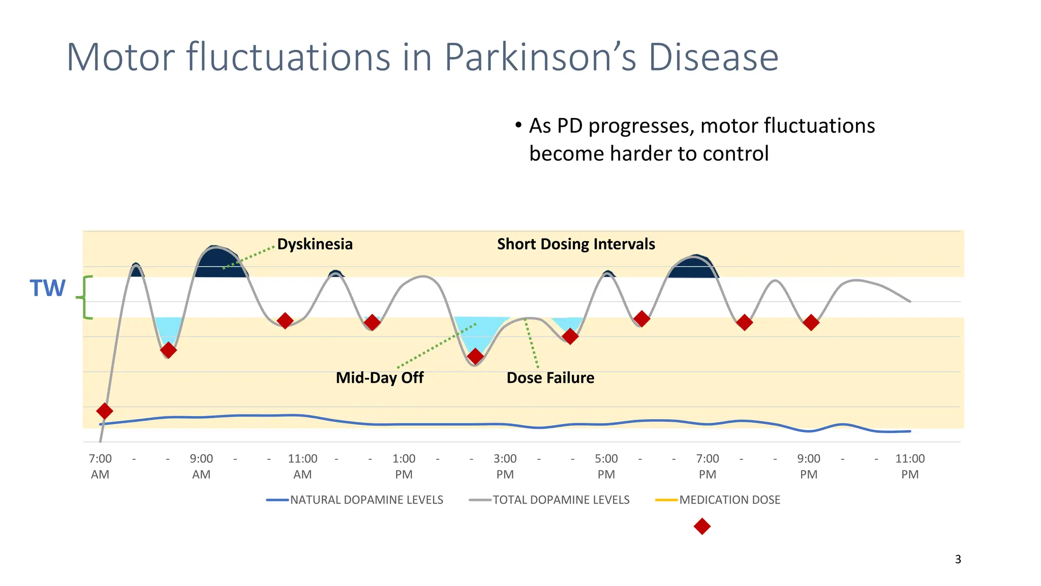 Surgical Approaches to Treat Parkinson's disease - 2025 Symposium | PDF