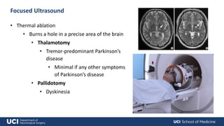 Surgical Approaches to Treat Parkinson's disease - 2025 Symposium | PDF