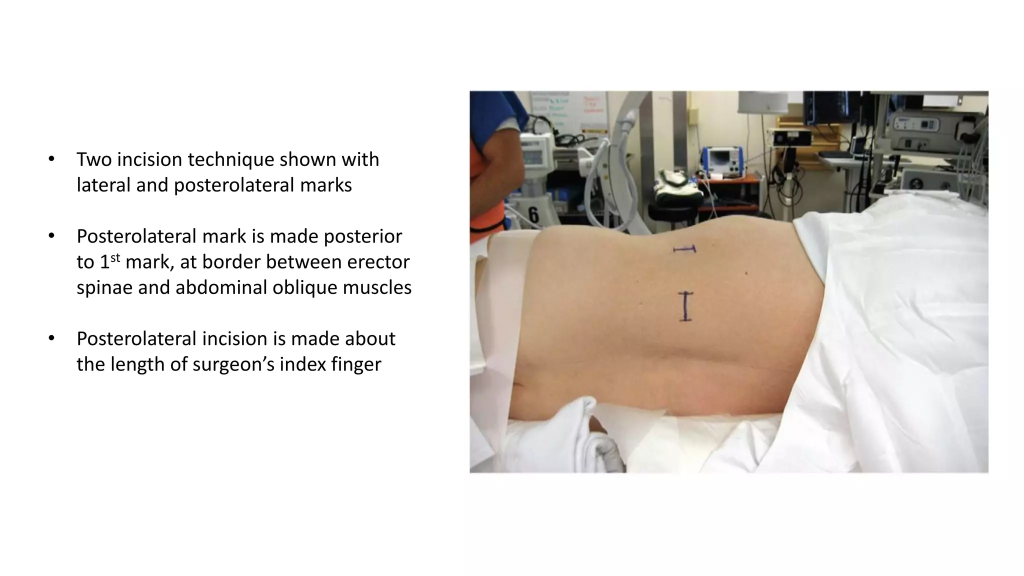 Surgical approach for thoracic and lumbosacral spine | PPTX