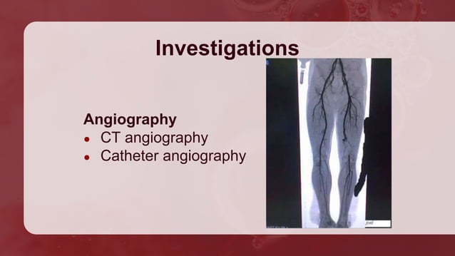 Surgical Approach for Vascular Extremiti | PPT