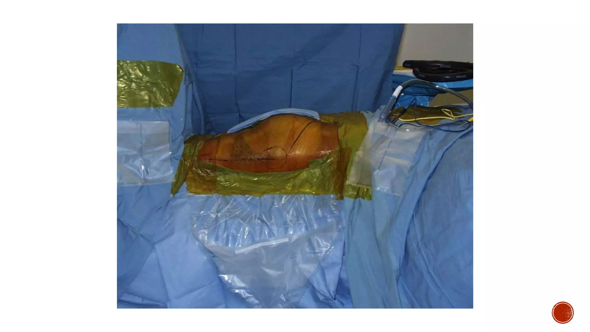 Surgical approach to acetabulum and pelvis | PPTX