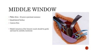 Surgical approach to acetabulum and pelvis | PPTX