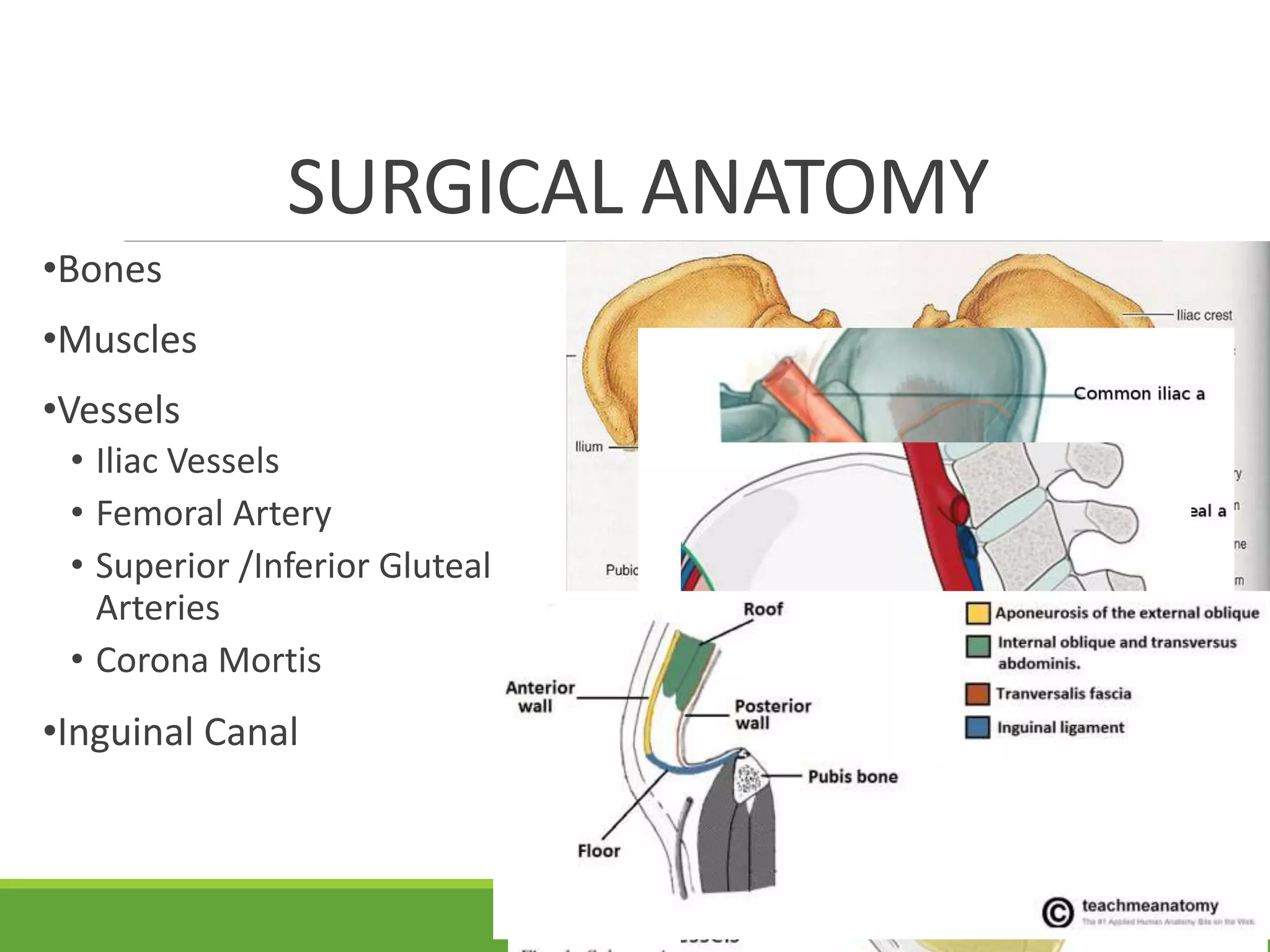 Surgical Approaches to Acetabulum and Pelvis | PPTX