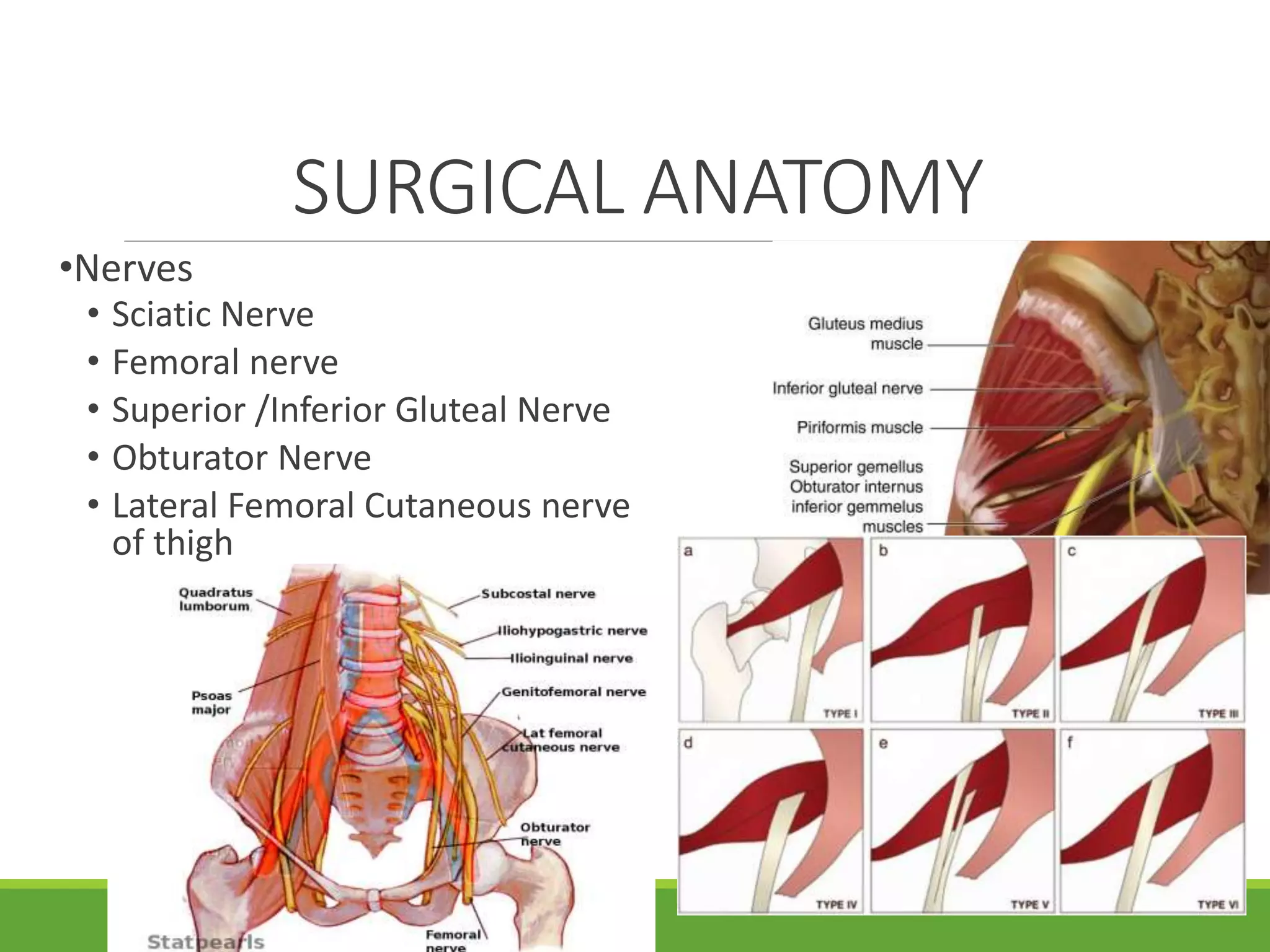 Surgical Approaches to Acetabulum and Pelvis | PPTX