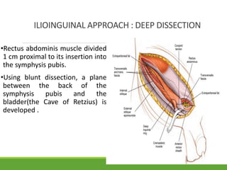 Surgical Approaches to Acetabulum and Pelvis | PPTX