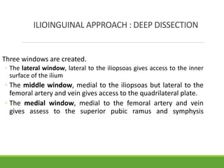 Surgical Approaches to Acetabulum and Pelvis | PPTX