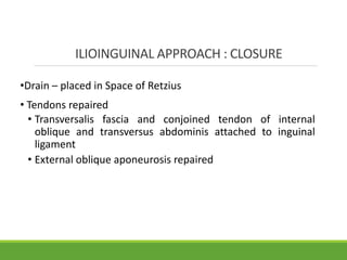 Surgical Approaches to Acetabulum and Pelvis | PPTX