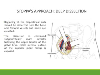 Surgical Approaches to Acetabulum and Pelvis | PPT