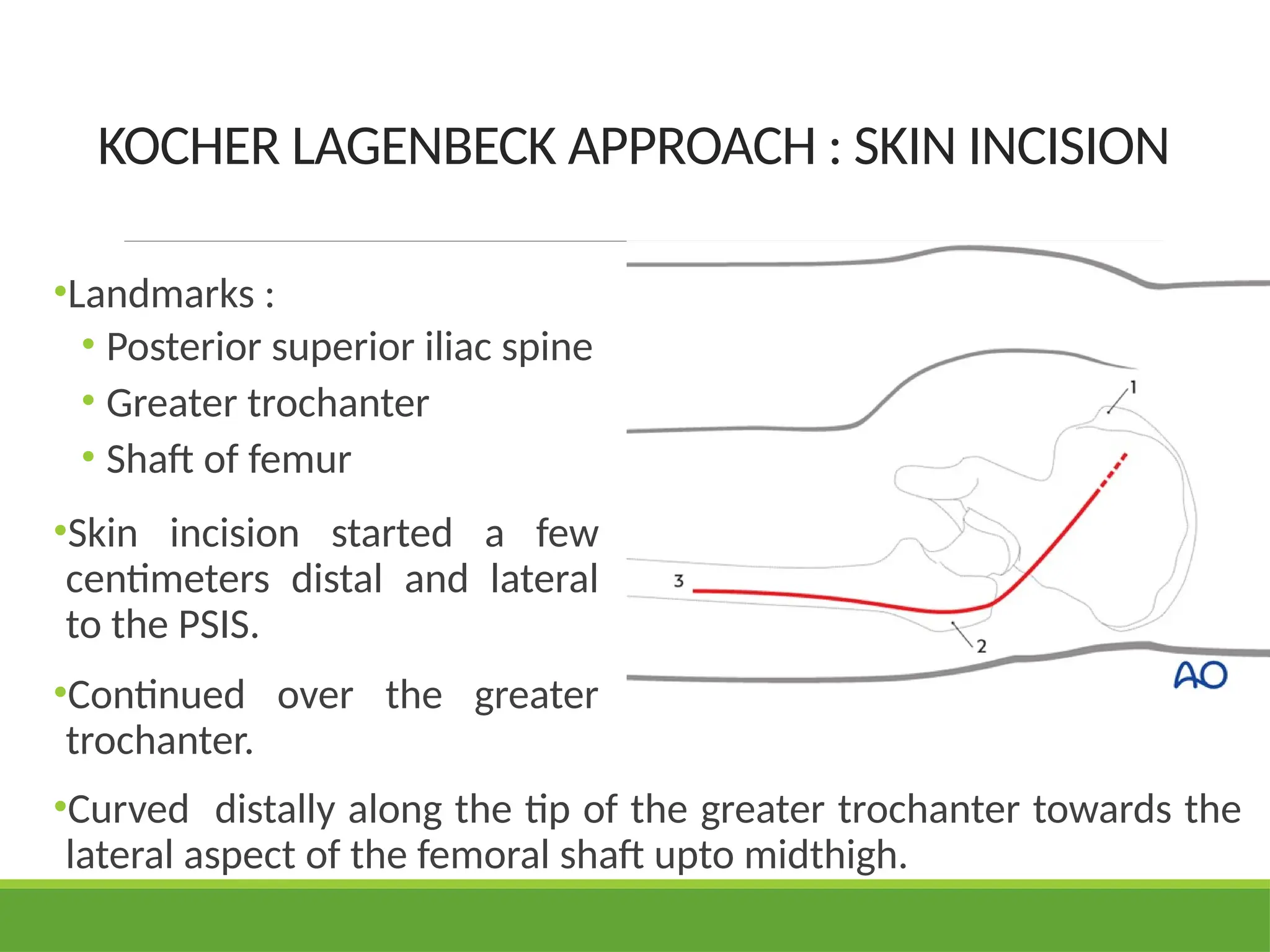 surgical approachto acetabulumand pelvis.pptx