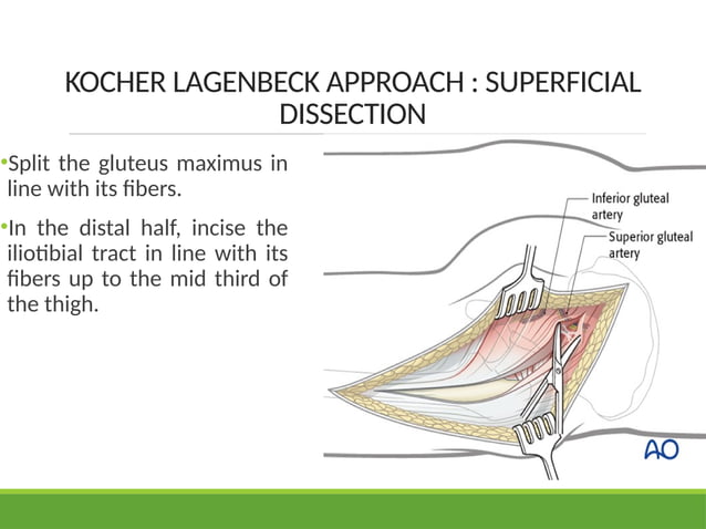 surgical approachto acetabulumand pelvis.pptx