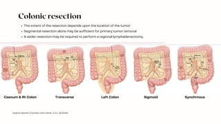 Surgical approach to Colorectal Tumor.pdf | Cancer | Diseases and ...