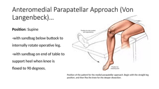 SURGICAL APPROACH TO KNEE JOINT PART 1 SIKU.pptx