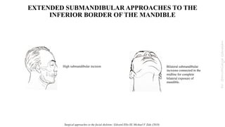 Surgical Approaches to the Mandible and Condyle | PDF