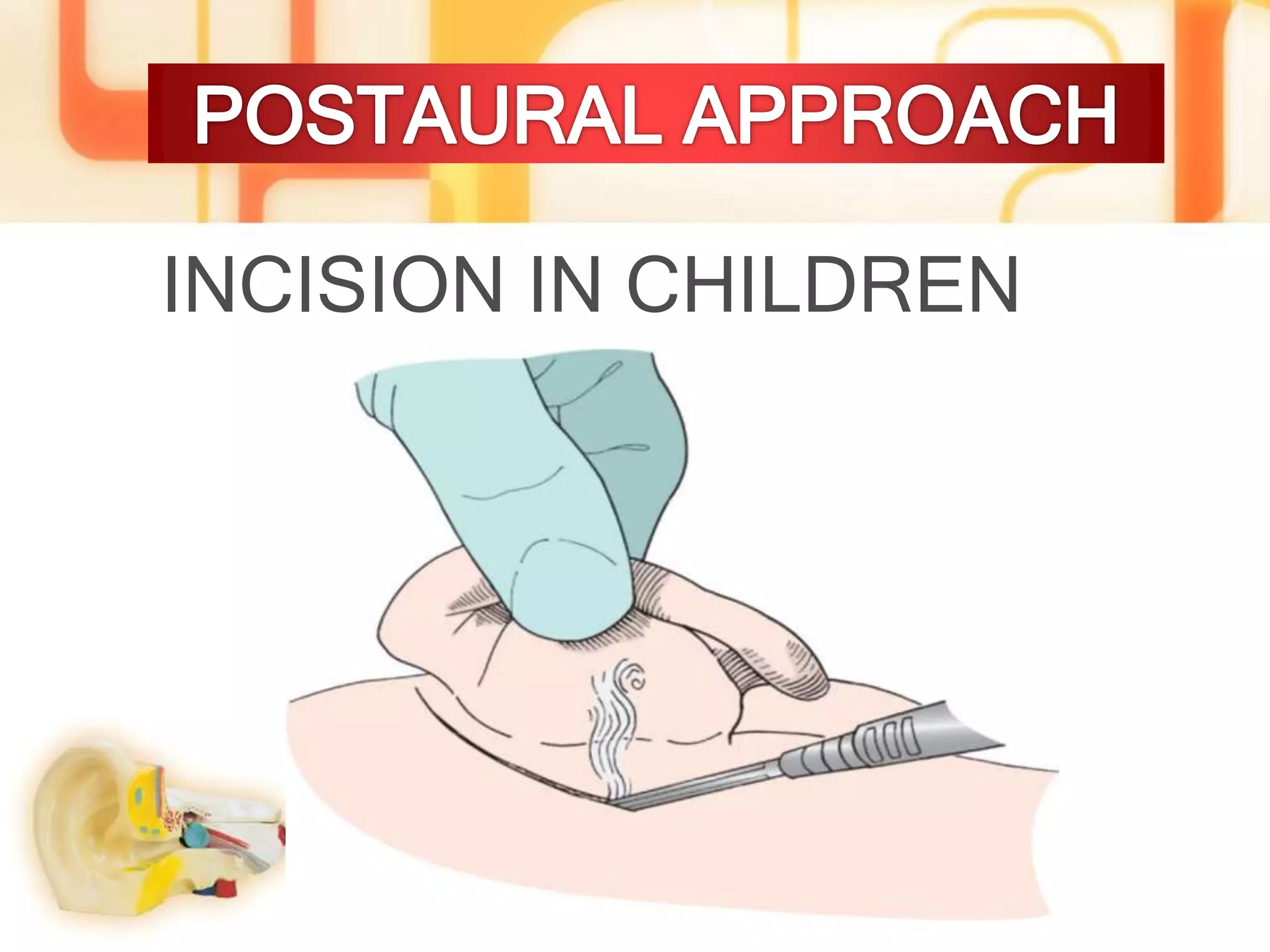 Surgical approach to middle ear,mastoid mamoon | PPTX