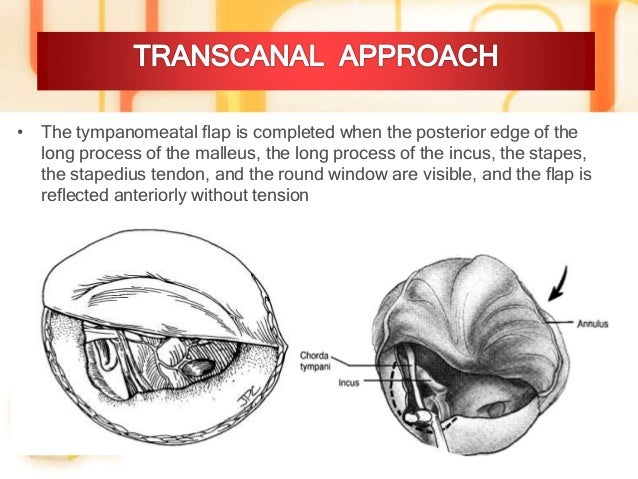 Surgical approach to middle ear,mastoid mamoon