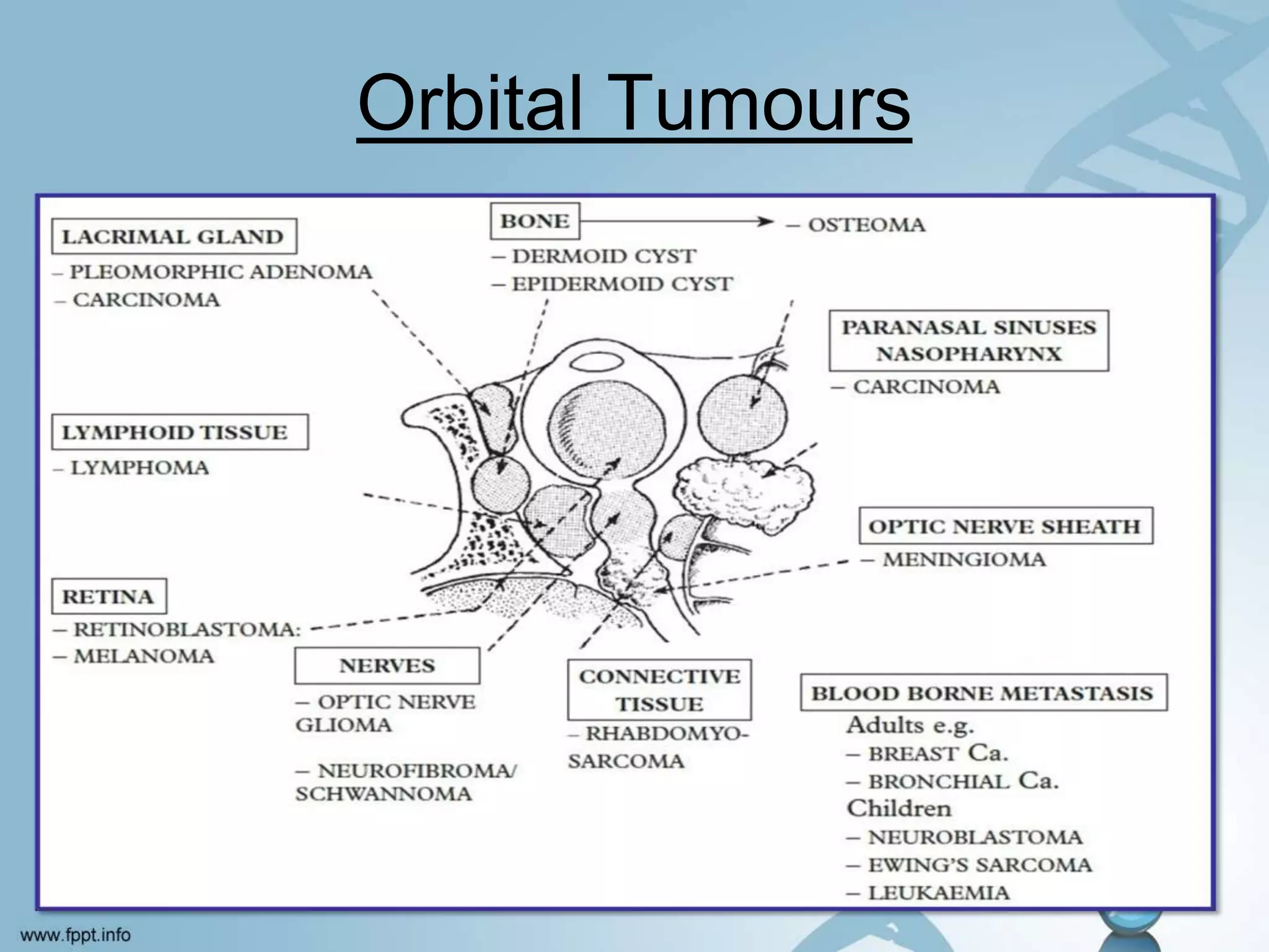 Surgical approach to orbital tumour | PPTX