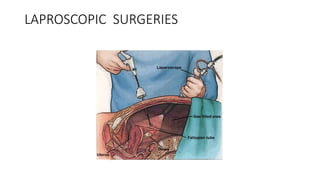 SURGICAL APPROCHES &INCISIONS.pptx
