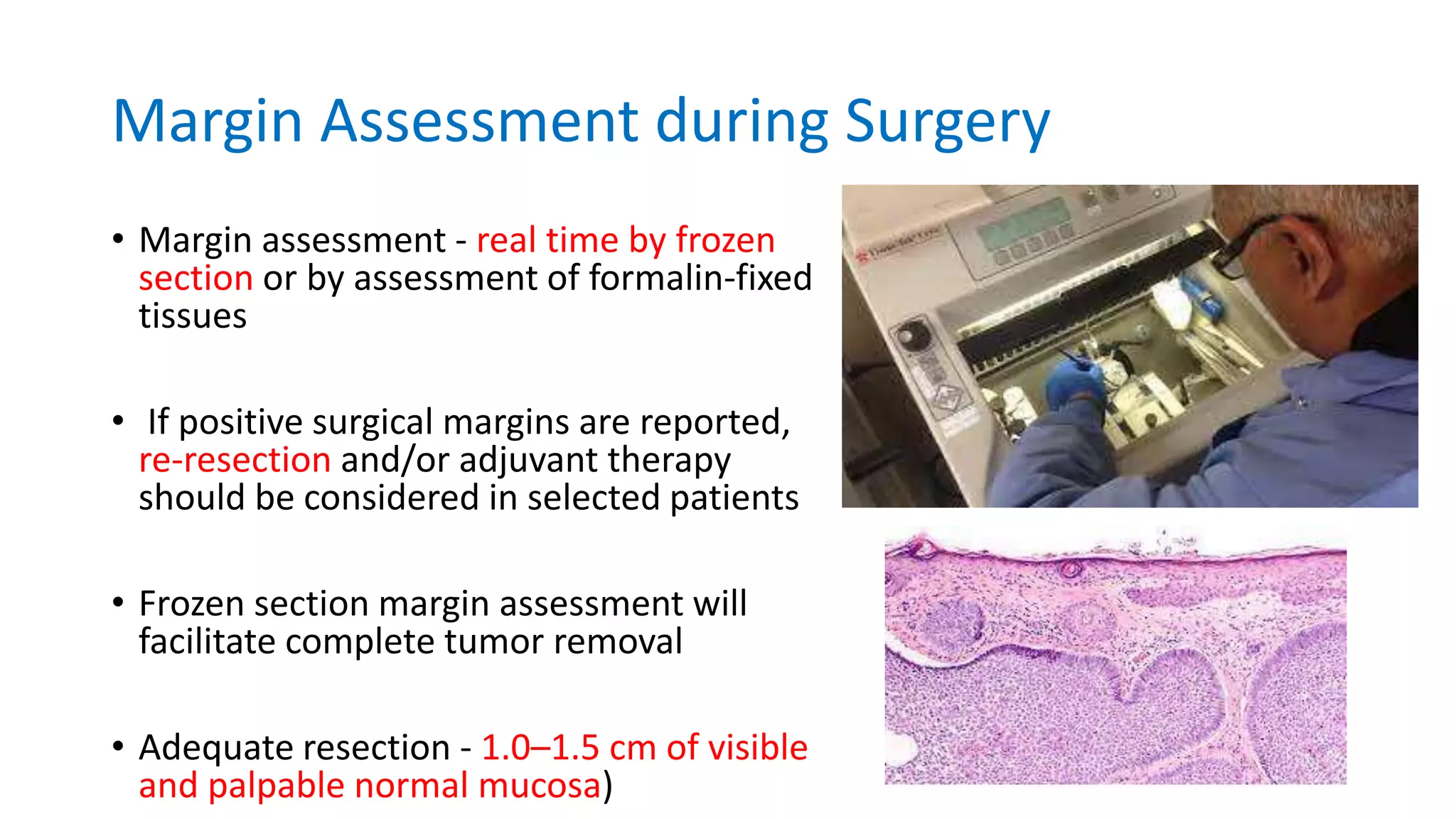 Surgical approach in oral cavity | PPTX