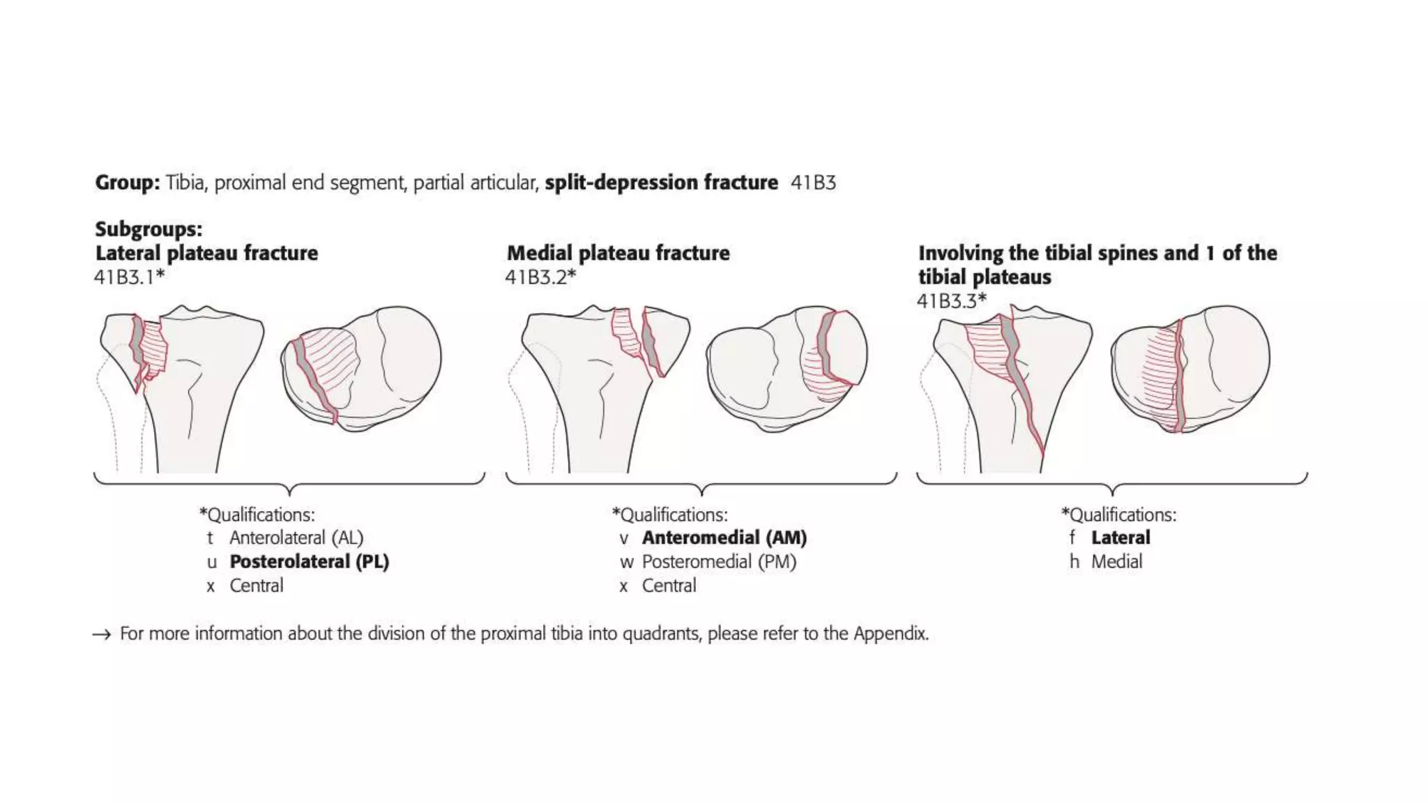Surgical approaches tibia fibula | PPTX