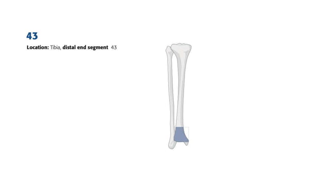 Surgical approaches tibia fibula | PPTX