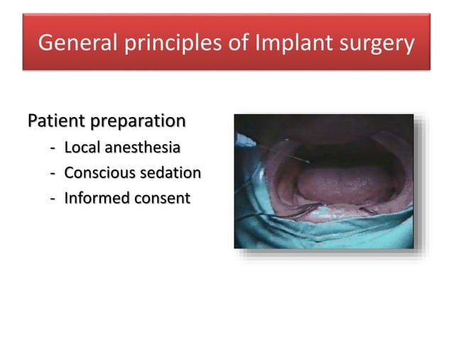 Surgical aspect of Dental Implants.pptx | Oral care | Personal Care