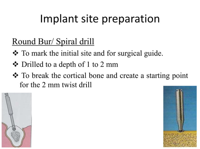 Surgical aspect of Dental Implants.pptx | Oral care | Personal Care