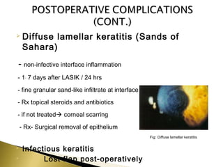 Surgical Aspect of Lasik | PPT