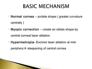 Surgical Aspect of Lasik | PPT