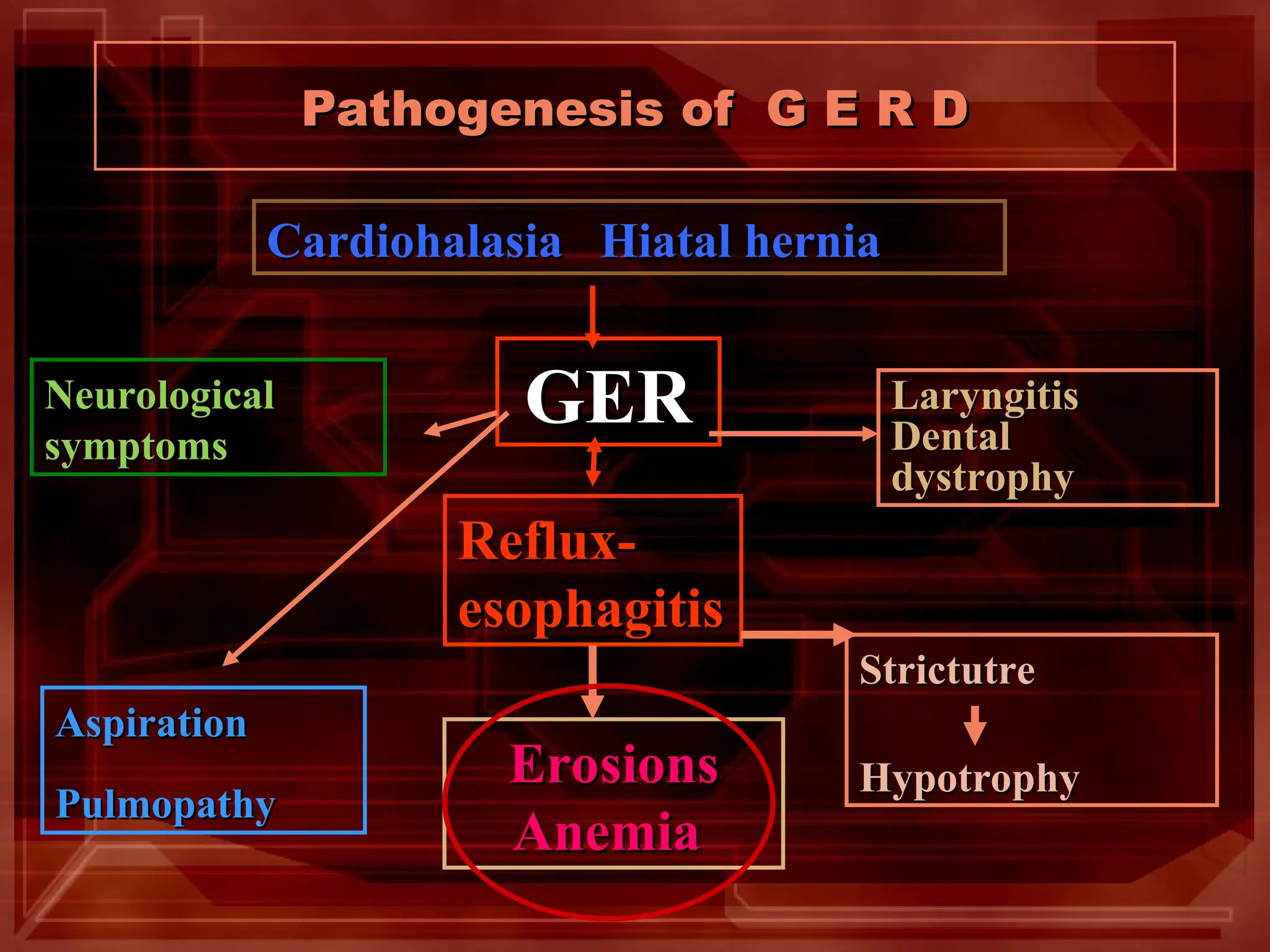 Surgical aspects in GERD in children.ppt