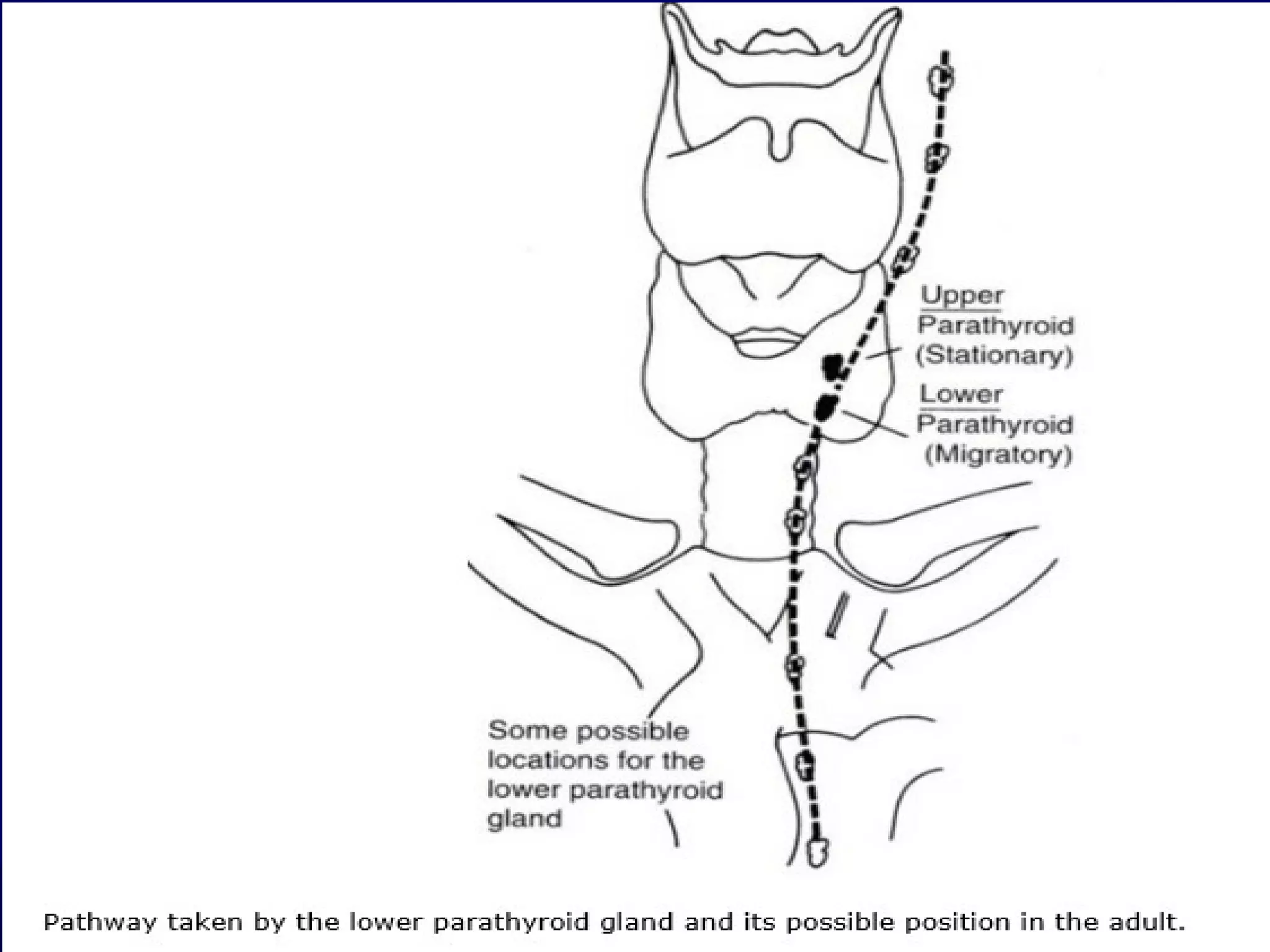 Surgical aspects of goitre | PPT