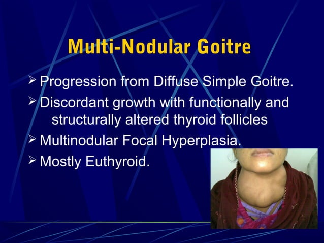 Surgical aspects of goitre | PPT