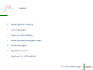 Surgical Assessment in Rhinoplasty | PPTX