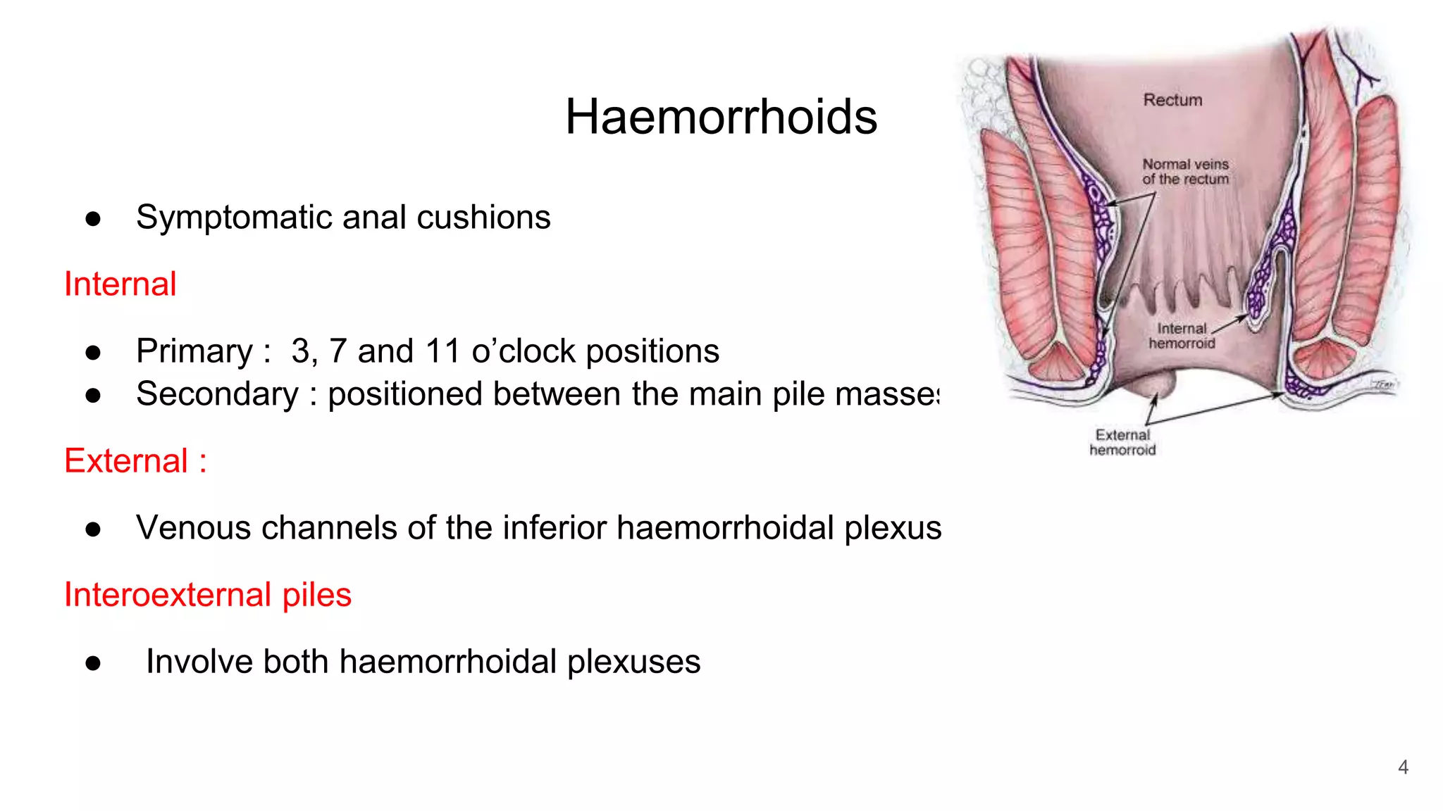 SURGICAL CAUSES OF ANEMIA HAEMORRHOIDS.pptx