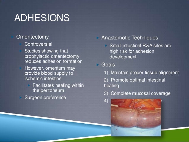 Surgical Complications