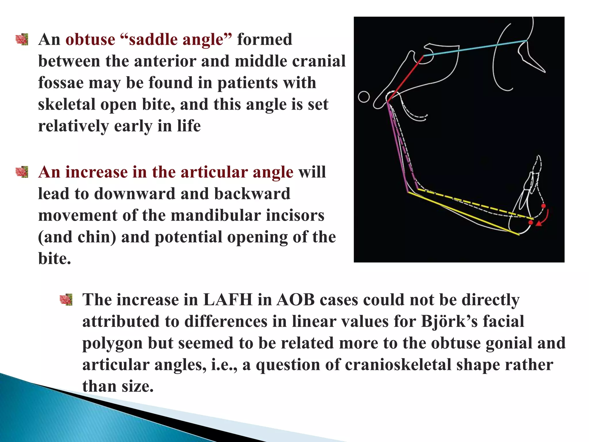 Surgical correction of anterior openbite | PPTX