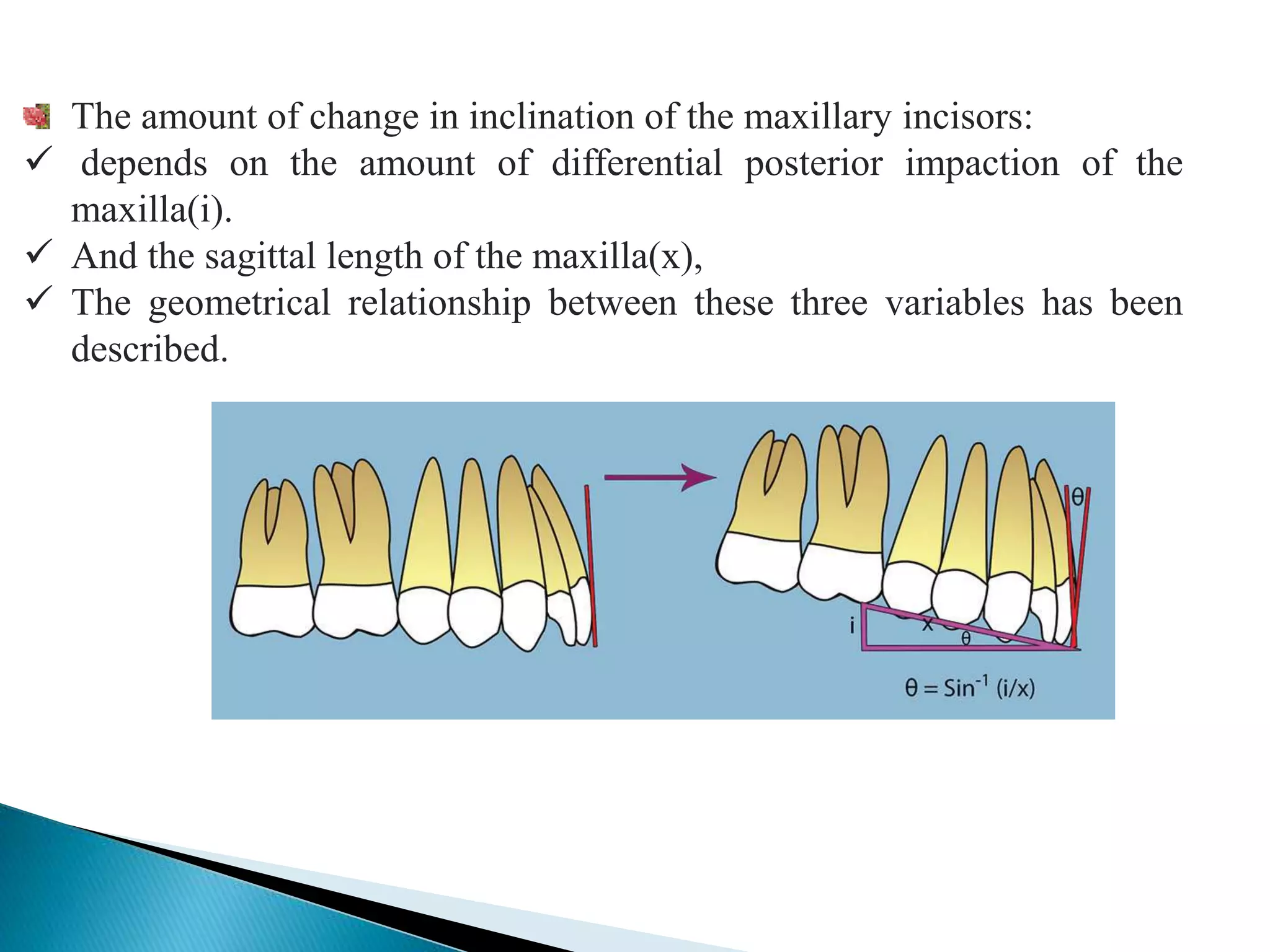 Surgical correction of anterior openbite | PPTX