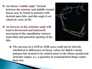 Surgical correction of anterior openbite | PPTX