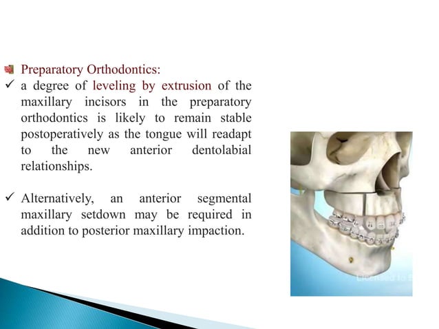 Surgical correction of anterior openbite | PPTX | Bone and Joint Conditions | Diseases and ...