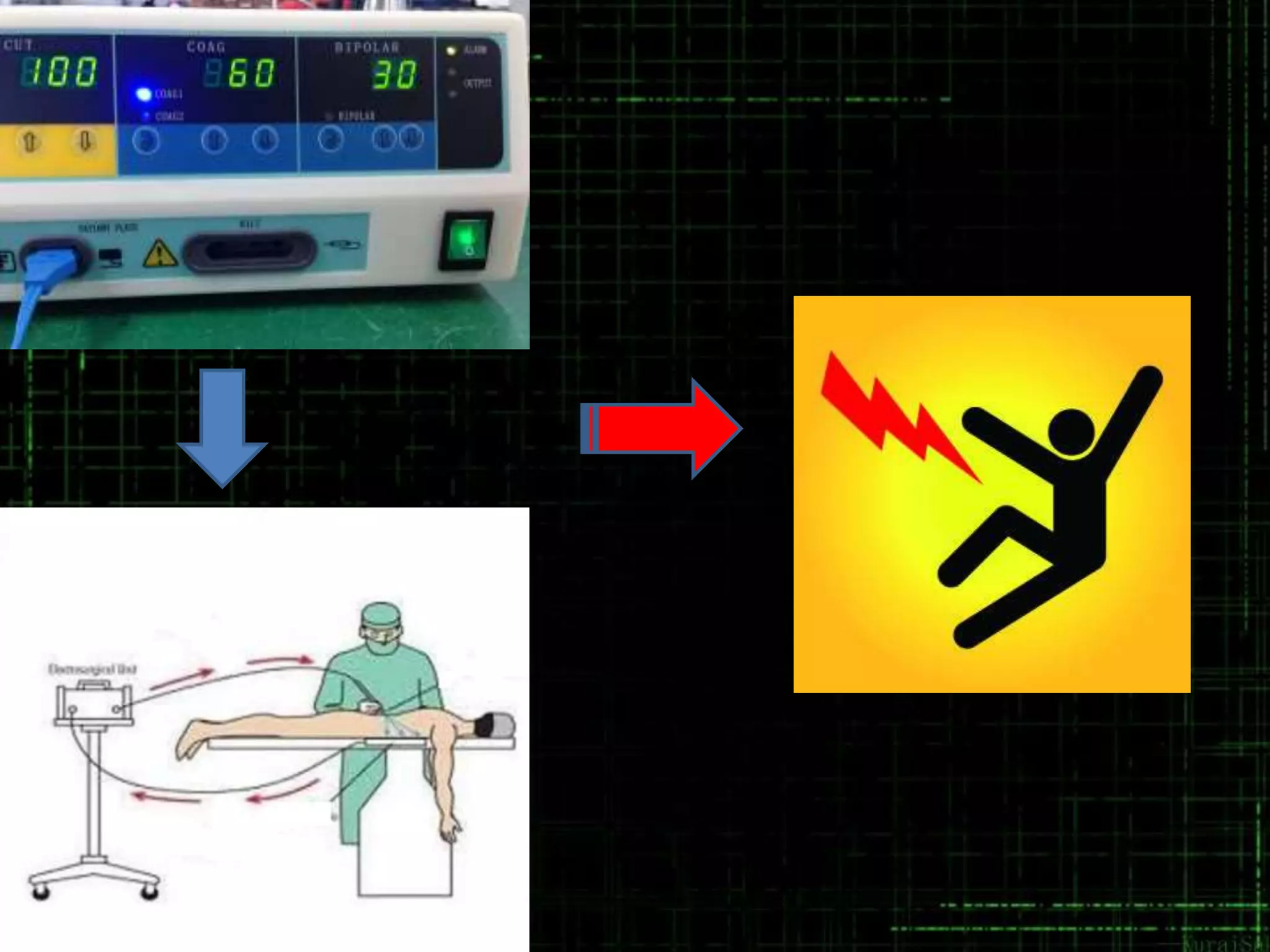 Surgical diathermy | PPTX